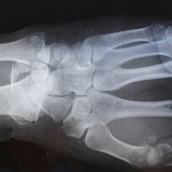 Uniblitz Optical Shutters, Laser Beam Shutters - Vincent Associates